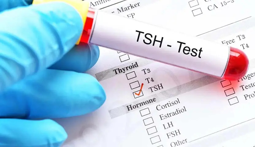 سعر تحليل الغدة الدرقية TSH في مصر اليوم 2026 دليل الأسعار
